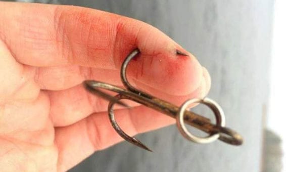 100 Reasons To Replace Your Treble Hooks (Graphic)