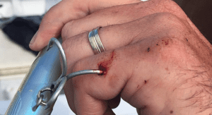 100 Reasons To Replace Your Treble Hooks (Graphic)